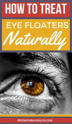 How to Naturally Treat Eye Floaters & Flashes at Home