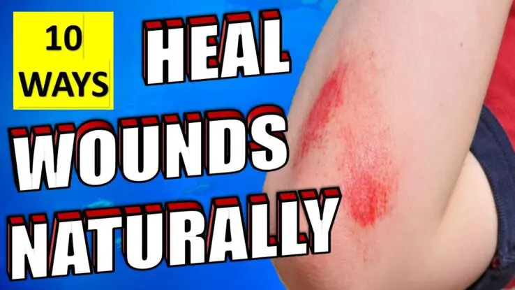 10 Natural Ways To Heal Wounds And Scrapes Fast & Quickly