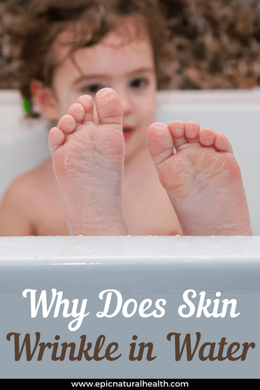 Wrinkled Skin From Water