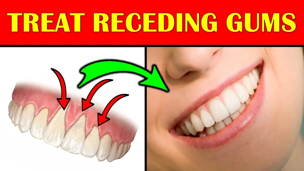 7 Effective Ways To Regrow Gums Naturally Epic Natural Health