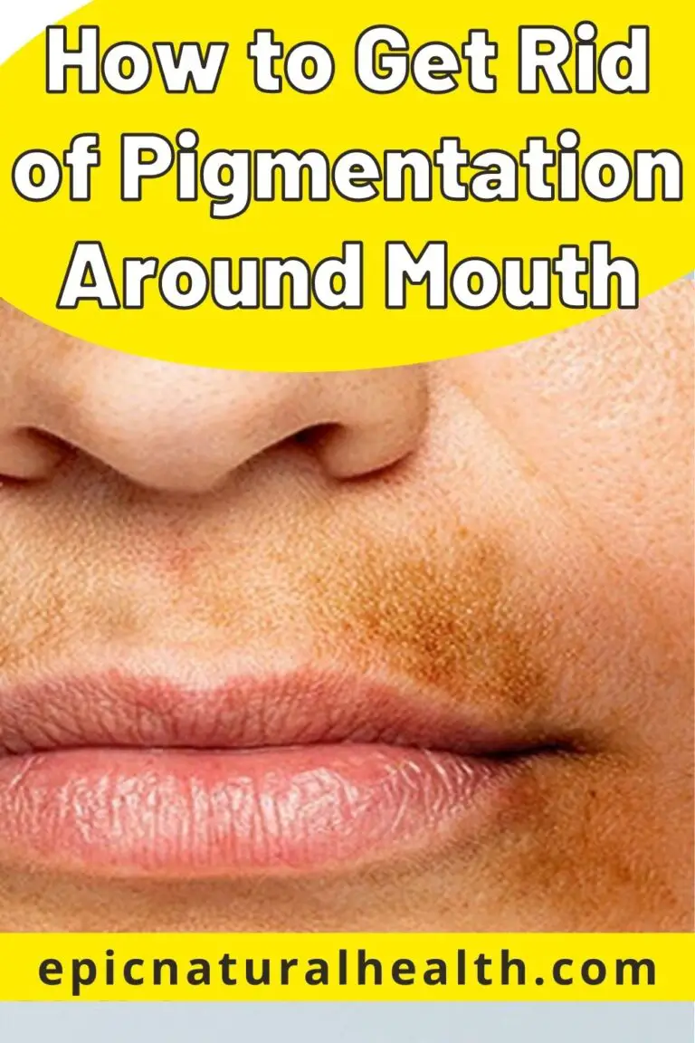 How to Get Rid of Pigmentation Around Mouth Naturally - Epic Natural Health